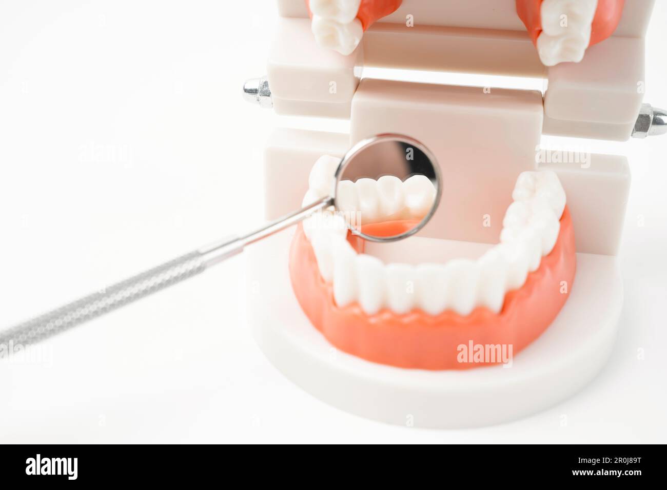 Teeth model showing an implant / dental demonstration teeth study teach ...