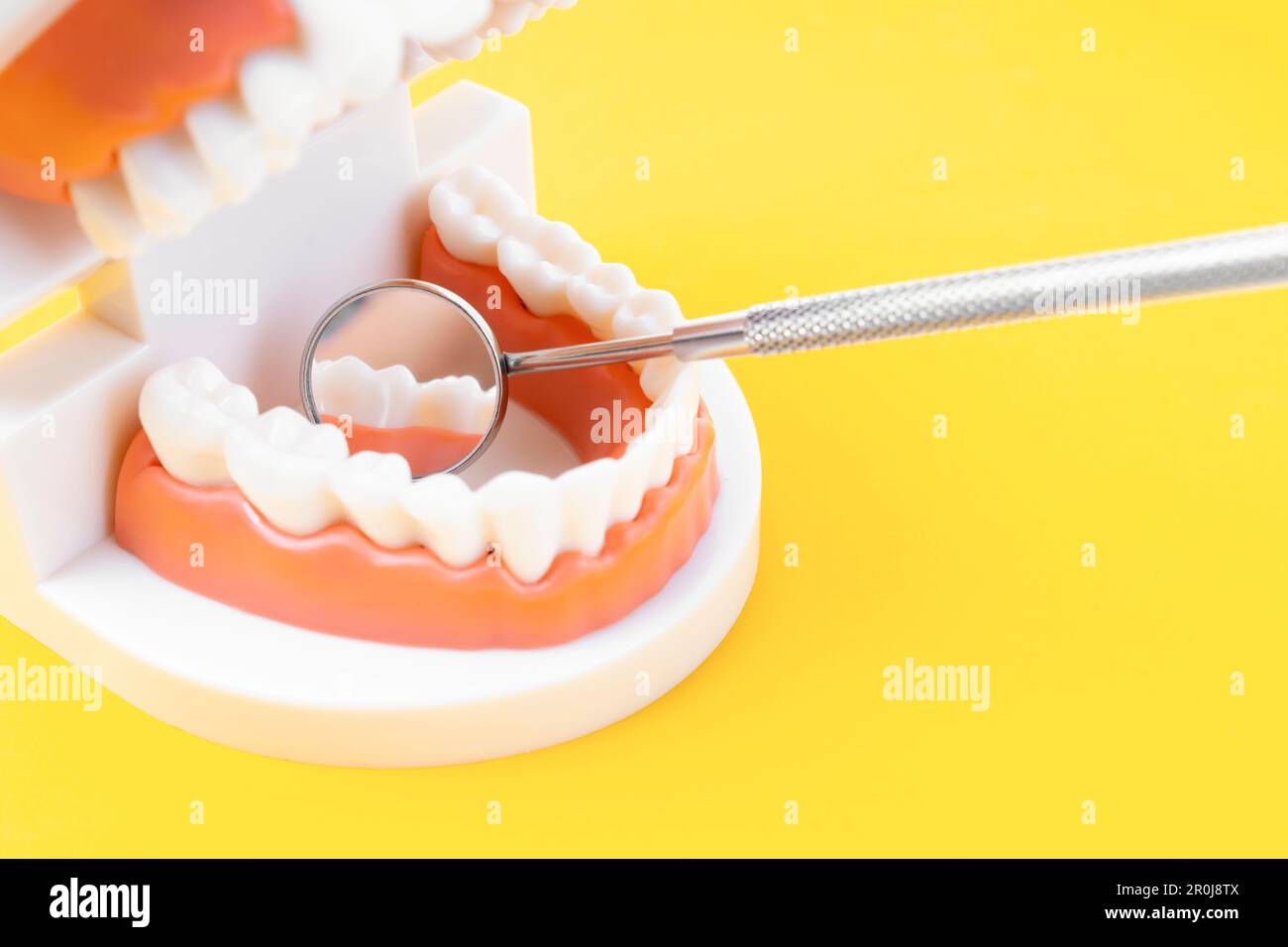 Teeth model showing an implant / dental demonstration teeth study teach ...