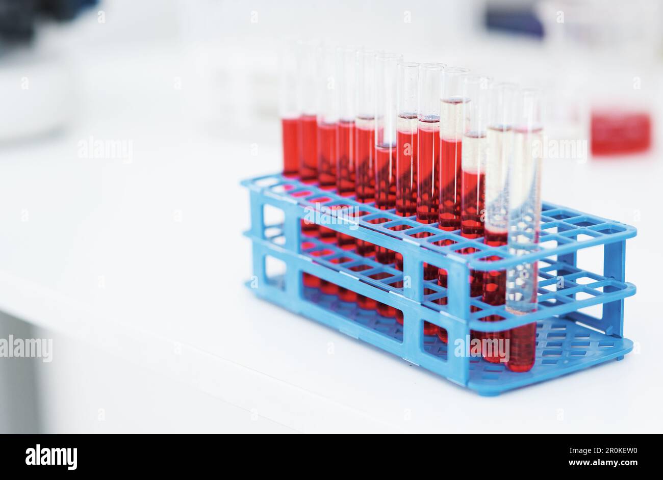 The samples are in. Closeup of a tray with test tubes filled with blood ...