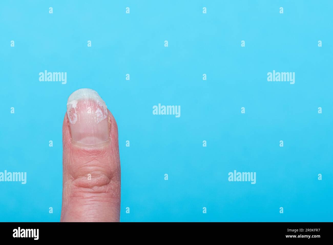 Dirty finger nails hi-res stock photography and images - Alamy