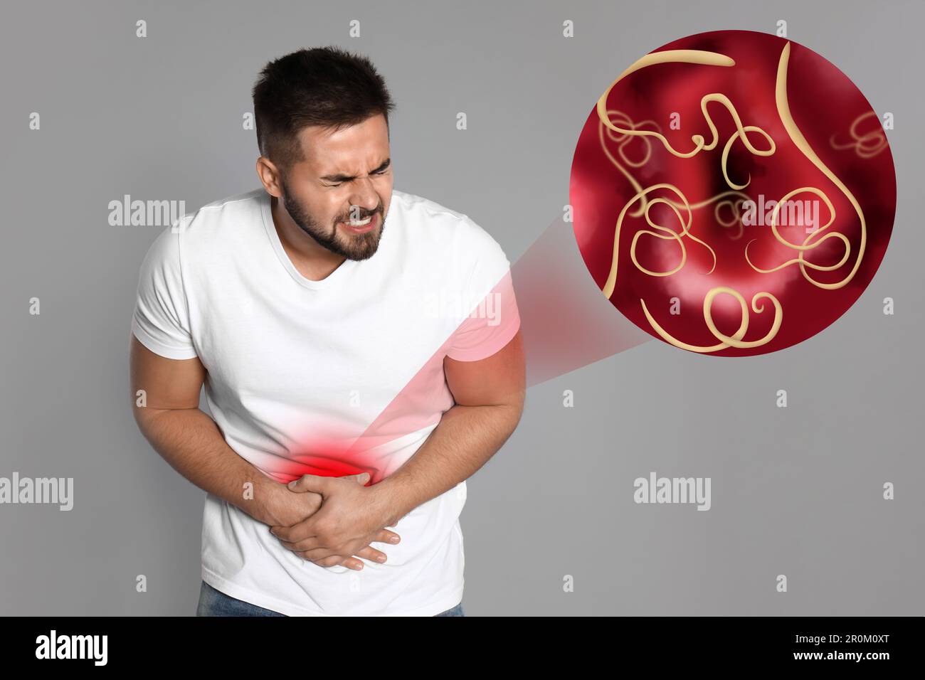 Parasites under microscope and man suffering from helminthiasis Stock ...