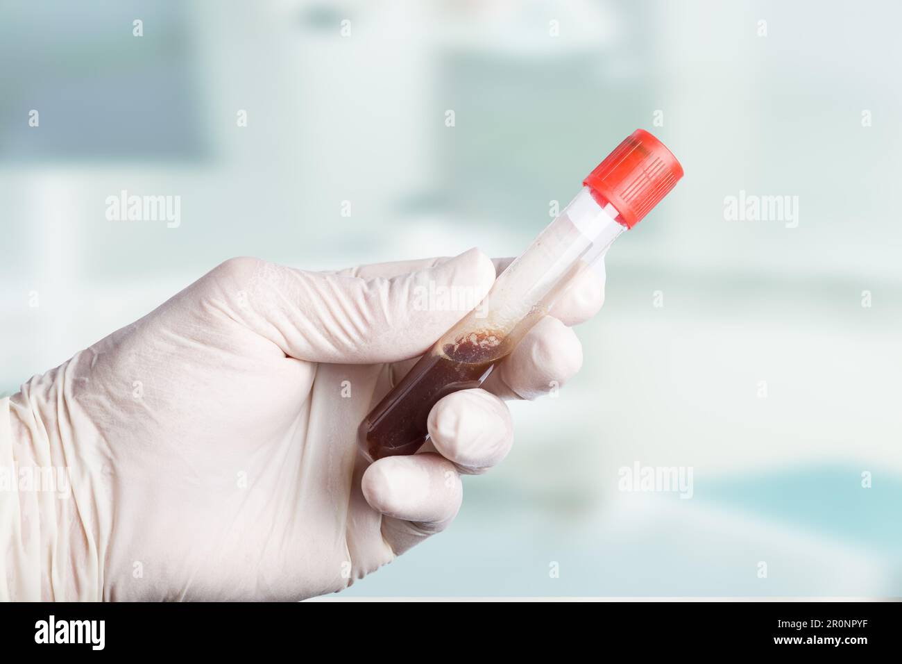 hand in medical gloves is handling a blood test tube in a laboratory ...