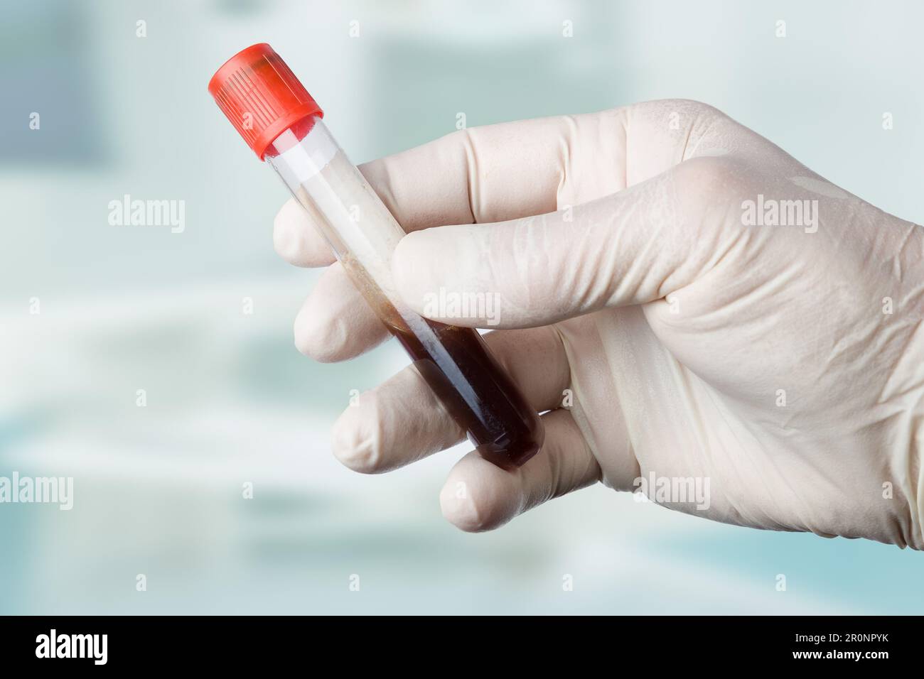 hand in medical gloves is handling a blood test tube in a laboratory ...