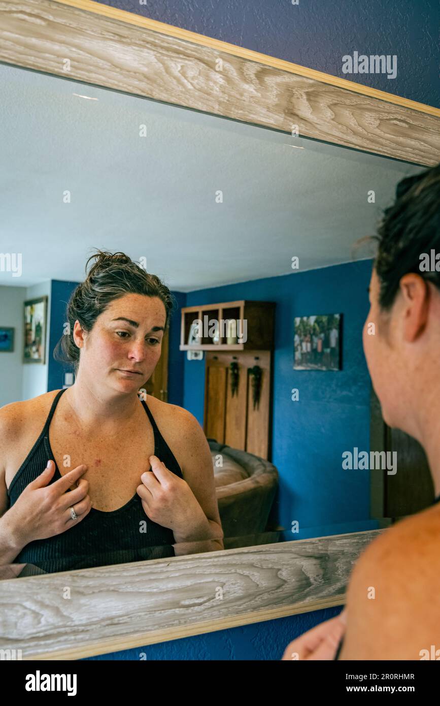 Basal Cell Carcinoma Young at Katie Kendall blog