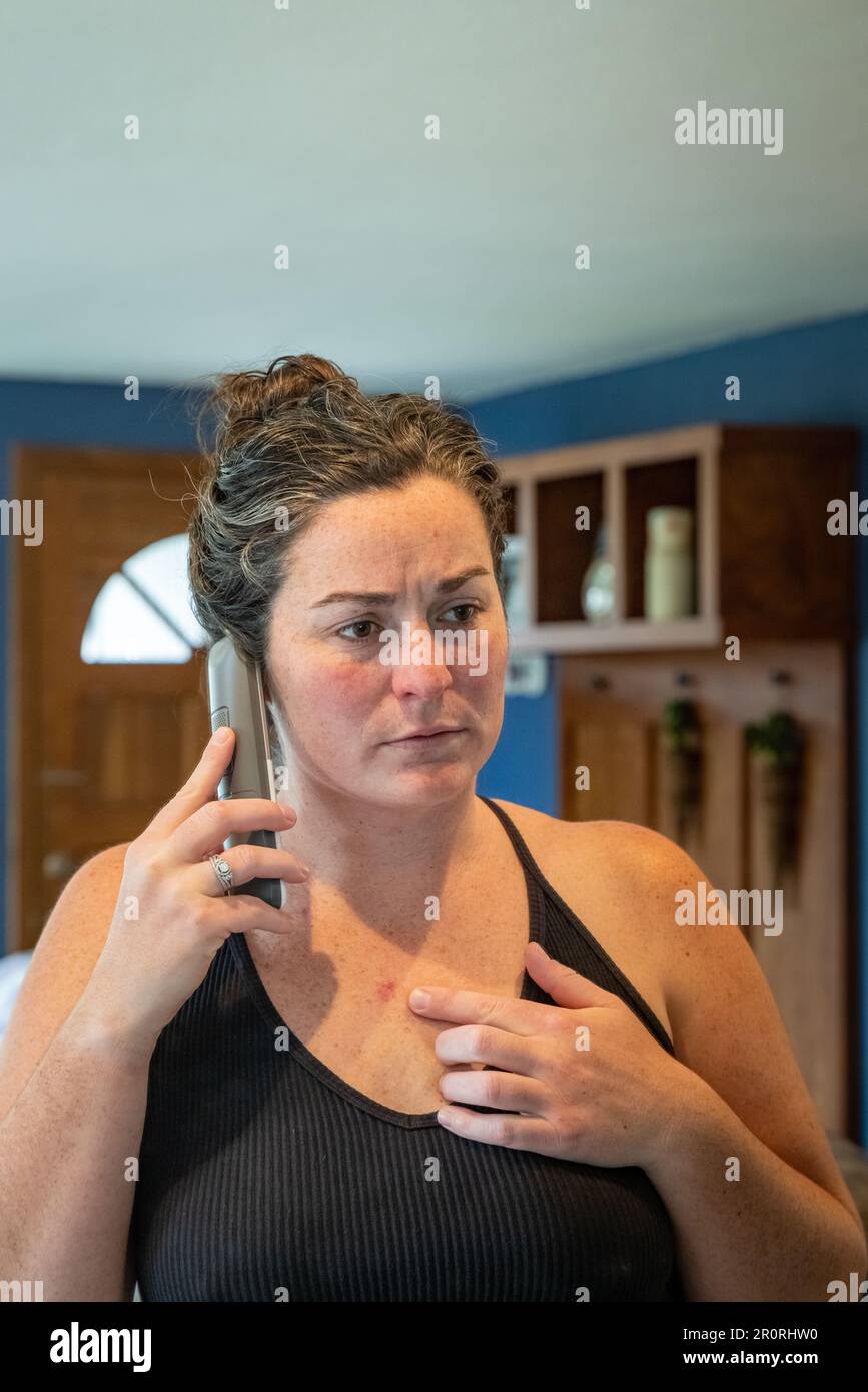 Basal Cell Carcinoma Young at Katie Kendall blog