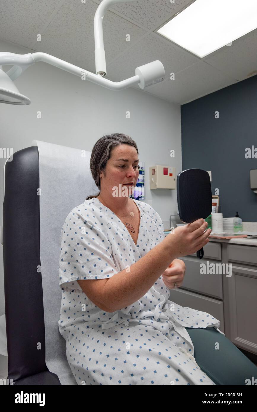 Basal cell carcinoma hand hi-res stock photography and images - Alamy