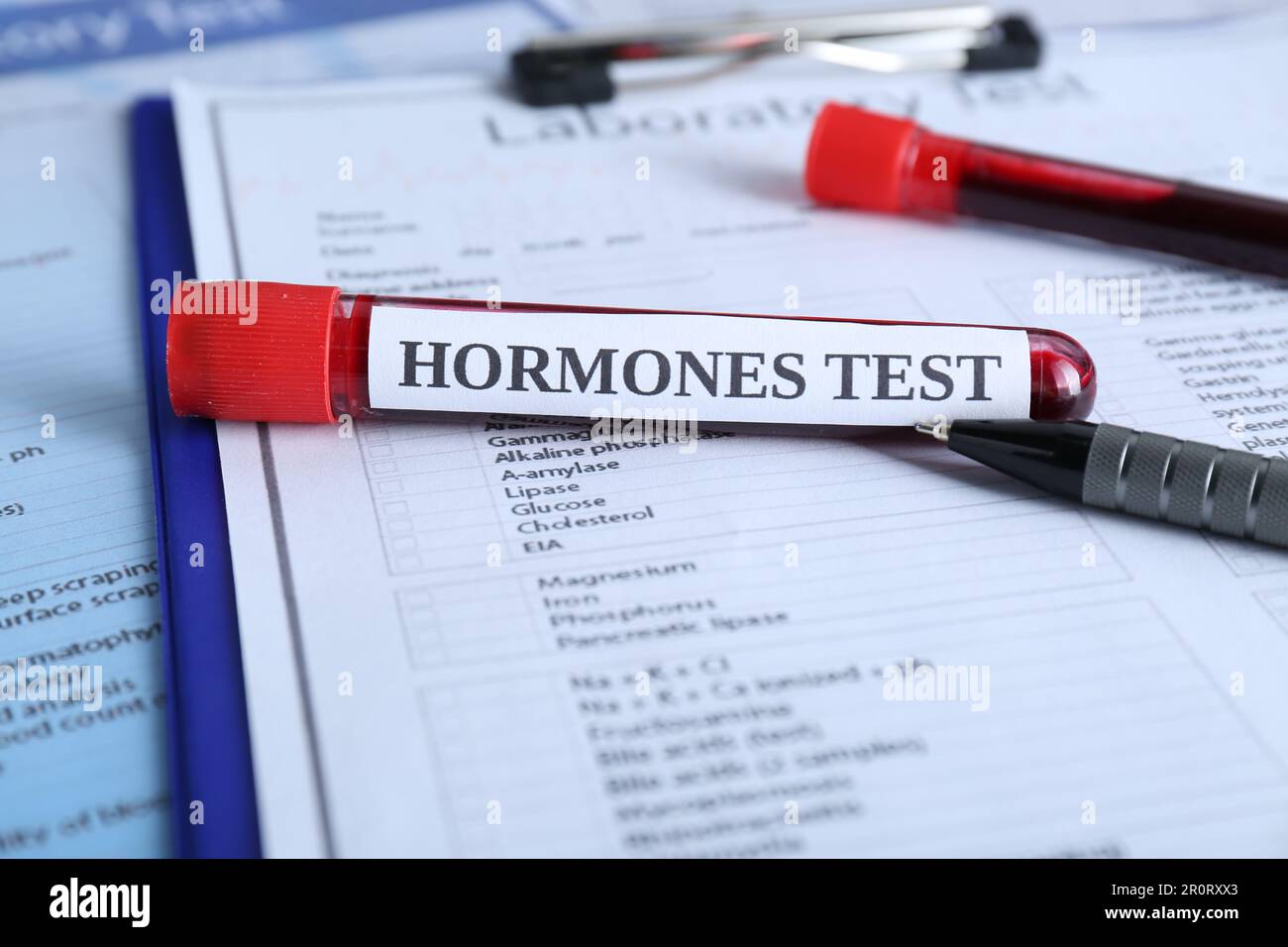Hormones test. Sample tube with blood on laboratory forms Stock Photo ...