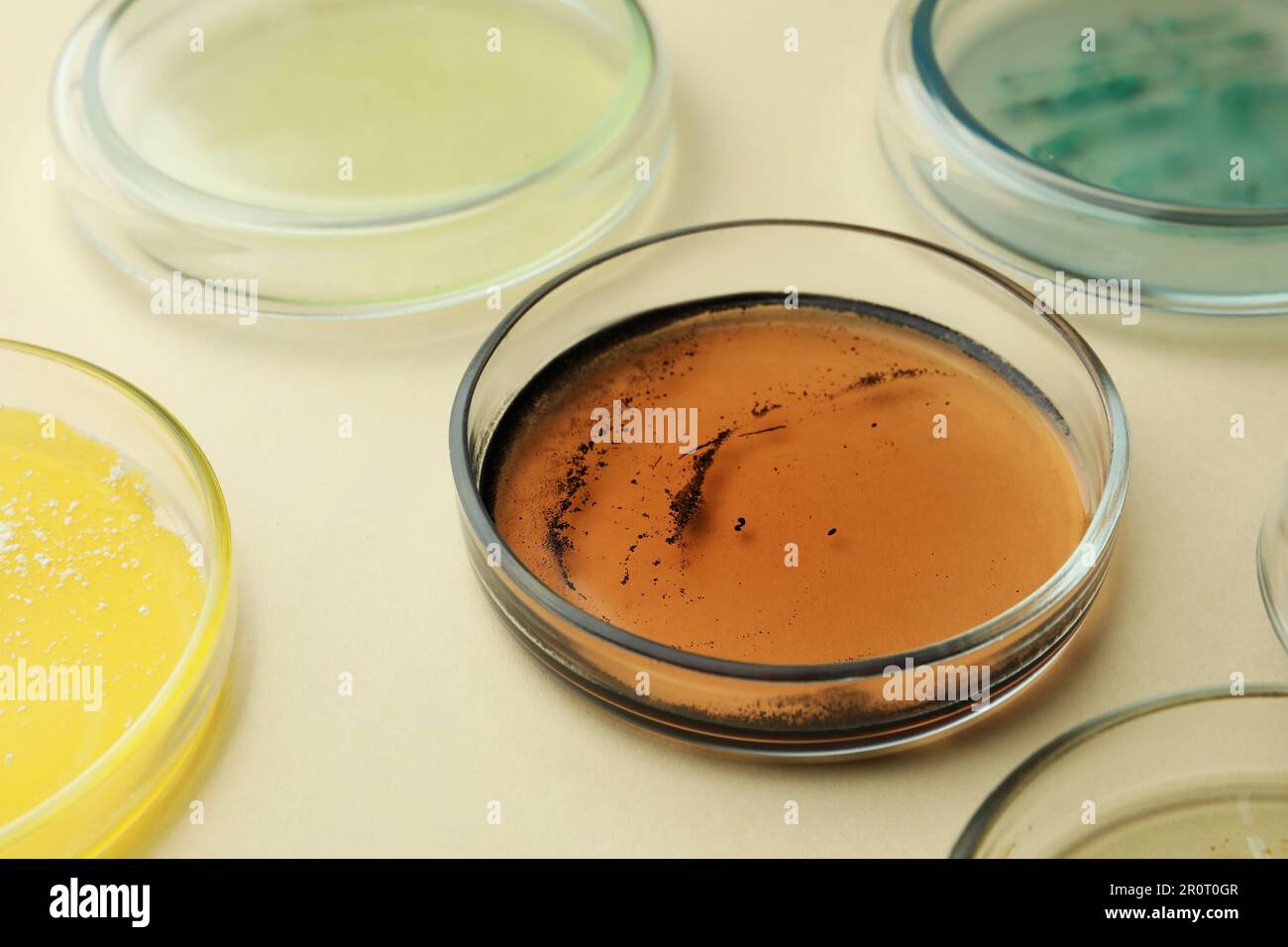 Petri dishes with different bacteria colonies on beige background ...