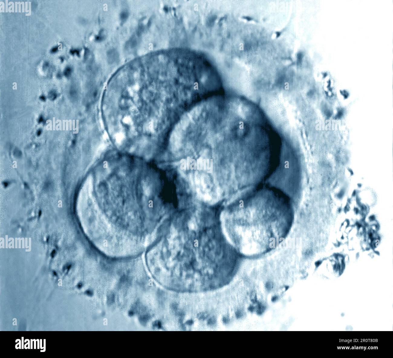 IVF embryo, light micrograph Stock Photo - Alamy