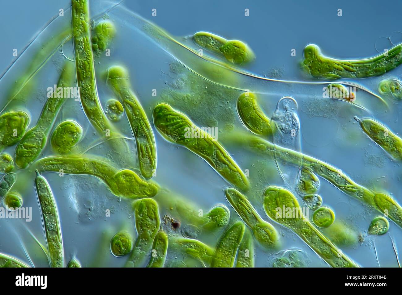 Protista Alga