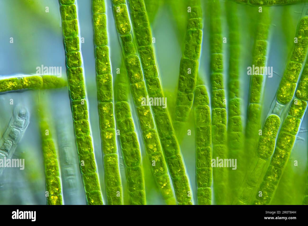 Tribonema algae, light micrograph Stock Photo - Alamy