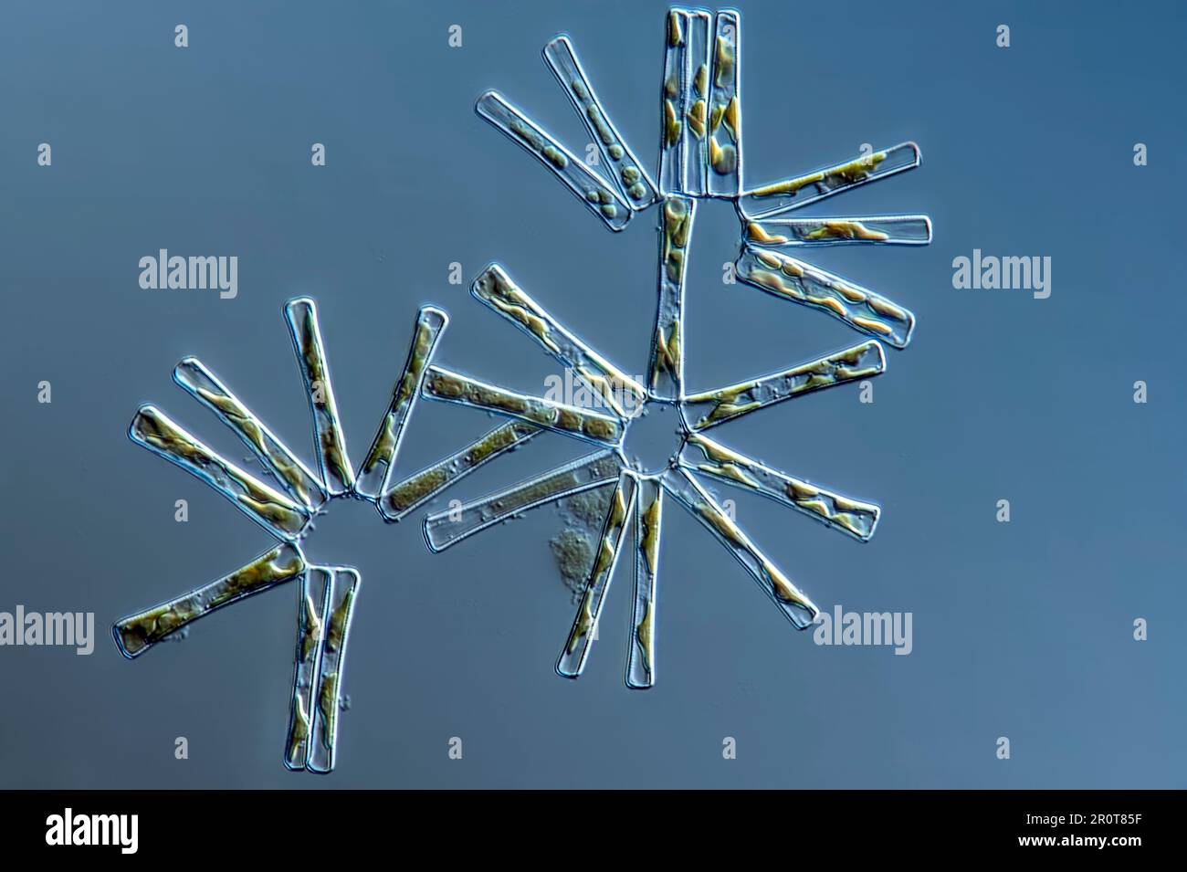Asterionella formosa algae, light micrograph Stock Photo - Alamy