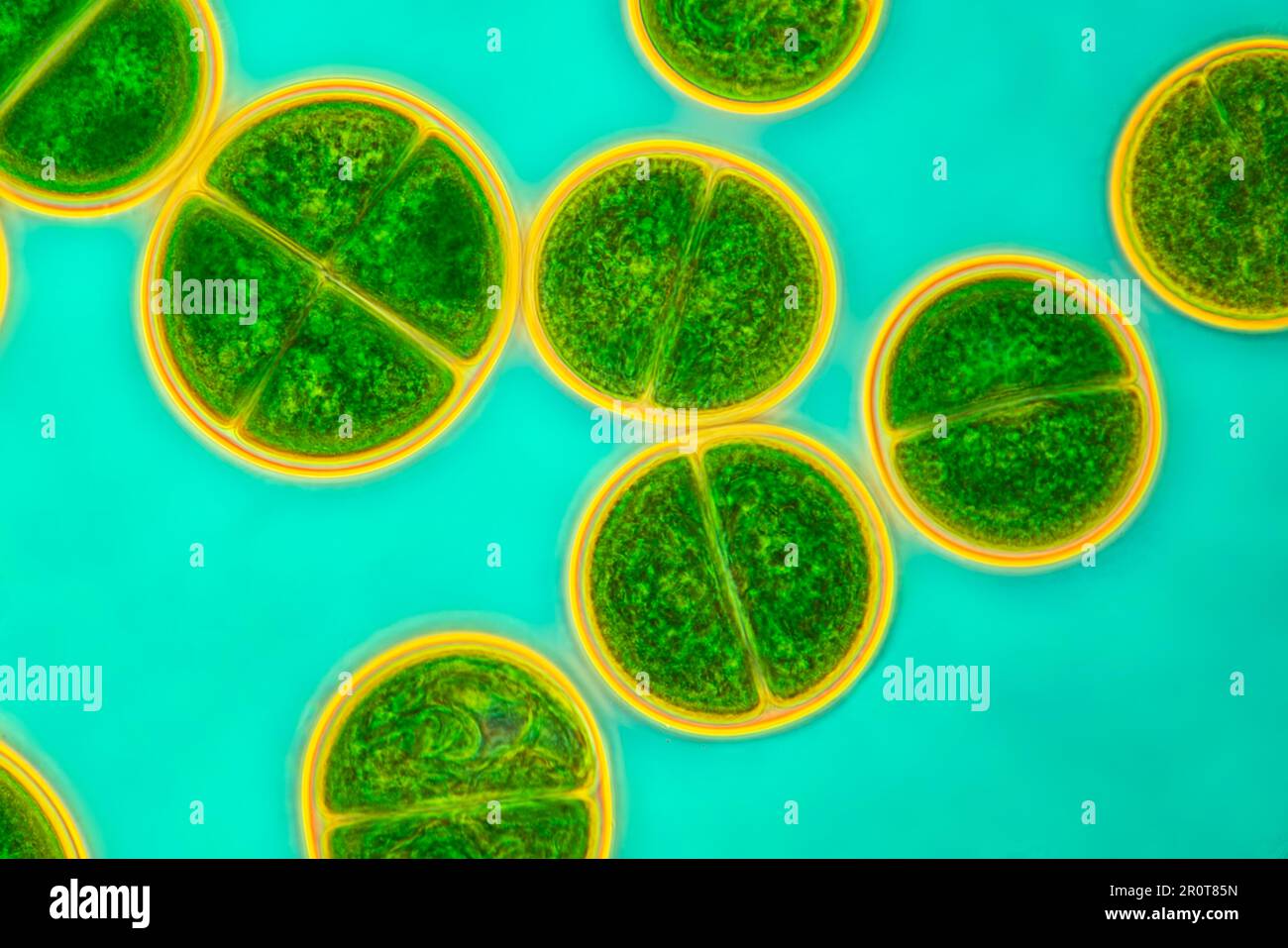 Chroococcus turgidus algae, light micrograph Stock Photo - Alamy