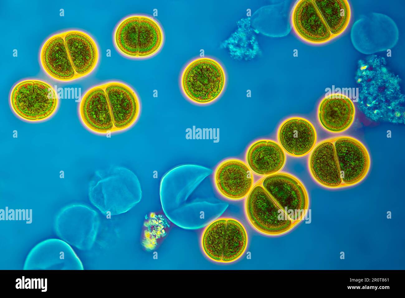 Chroococcus turgidus algae, light micrograph Stock Photo - Alamy