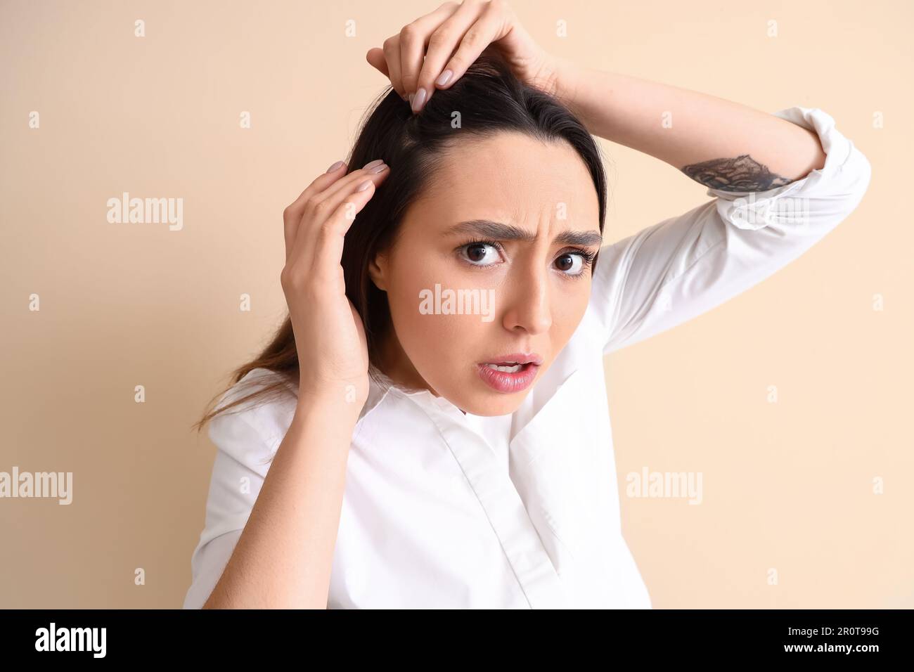 Worried young woman with hair loss problem on beige background Stock ...