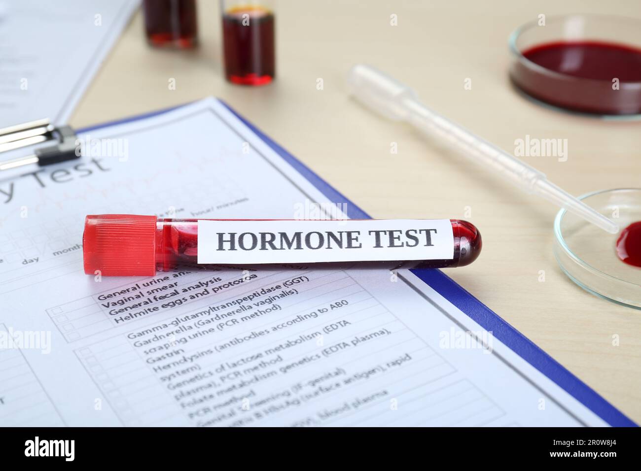 Hormone test. Sample tube with blood and laboratory forms on table ...