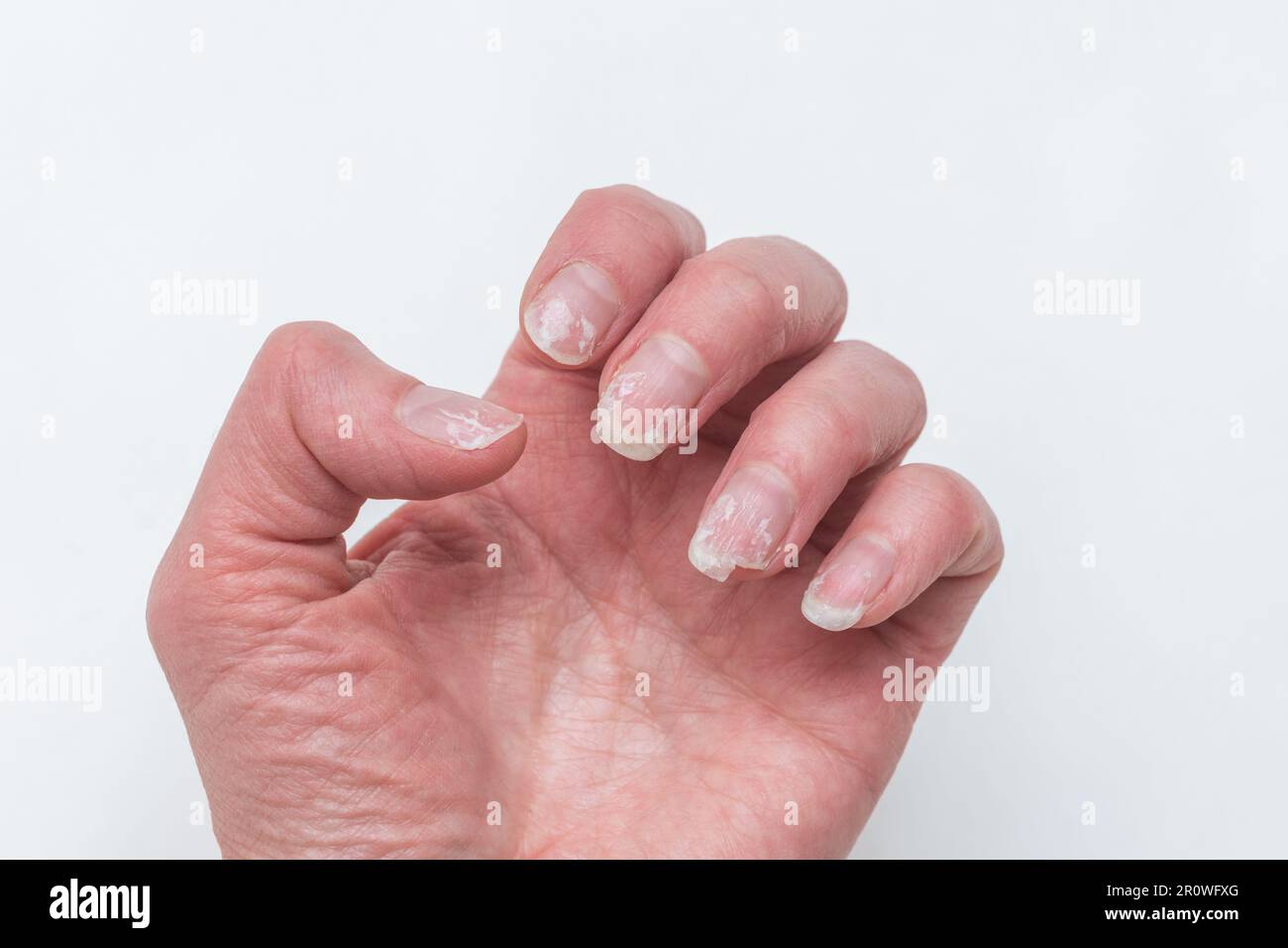 Woman hand without nail polish hi-res stock photography and images - Alamy