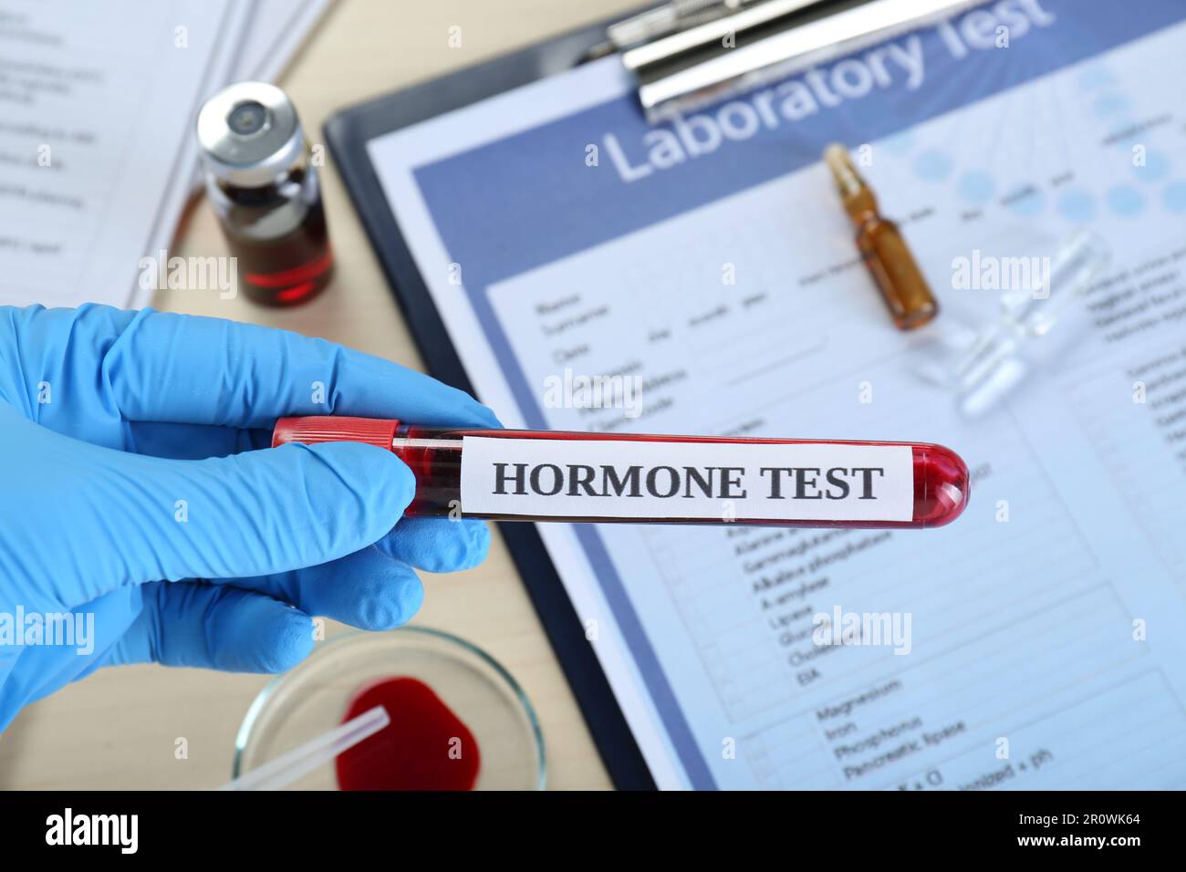 Hormones hormone hormonal hi-res stock photography and images - Alamy