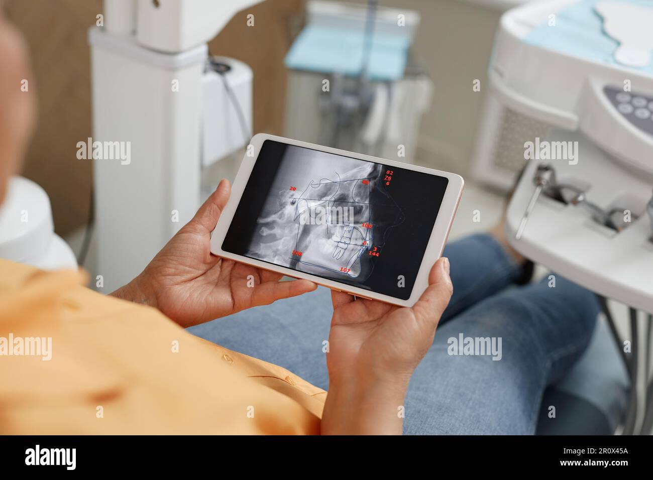 Closeup of woman holding digital tablet with tooth X-ray image at ...