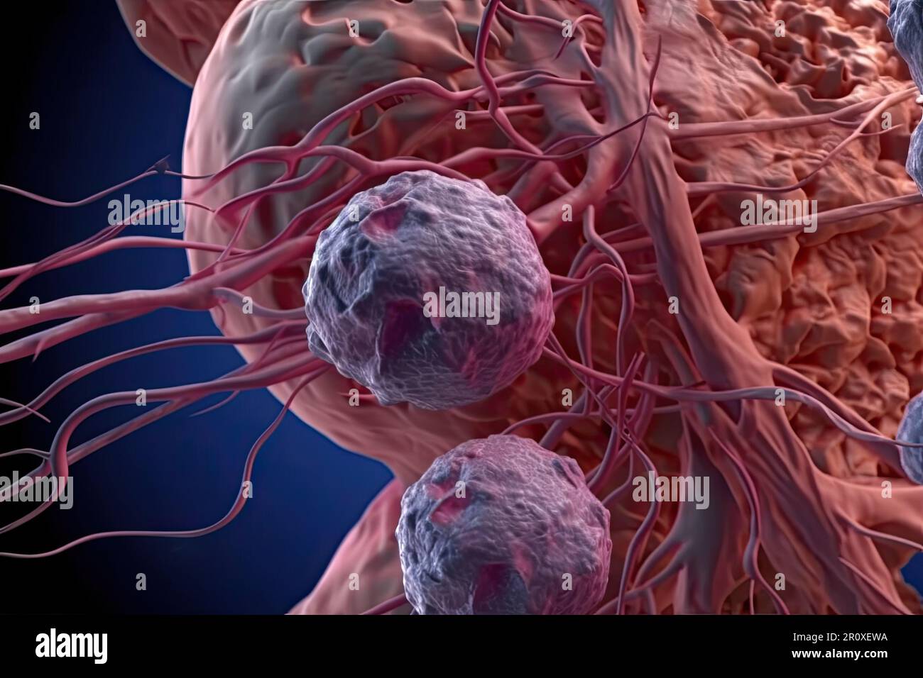 Human Diseases Cancer