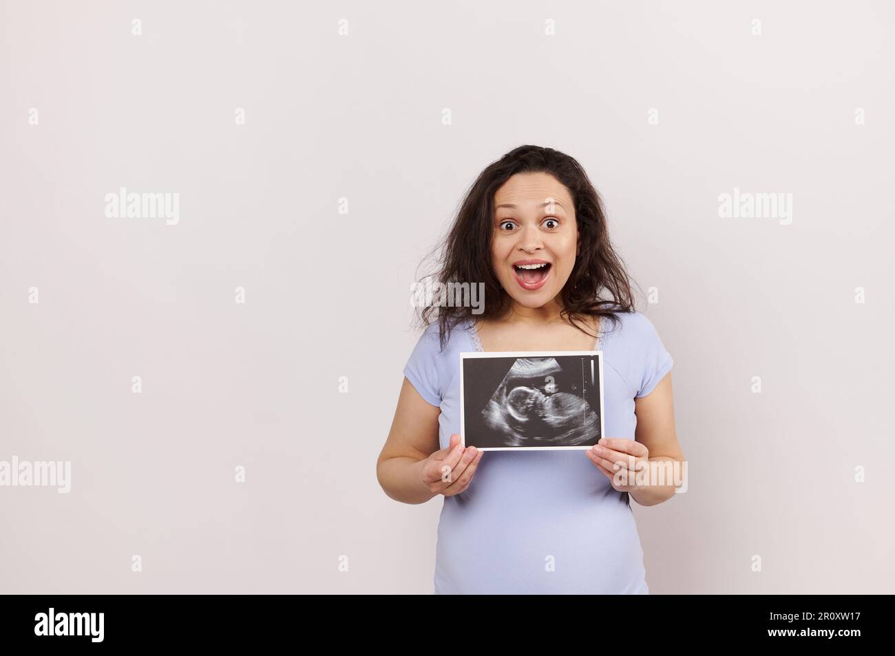 Happy pregnant woman shows ultrasound hi-res stock photography and ...