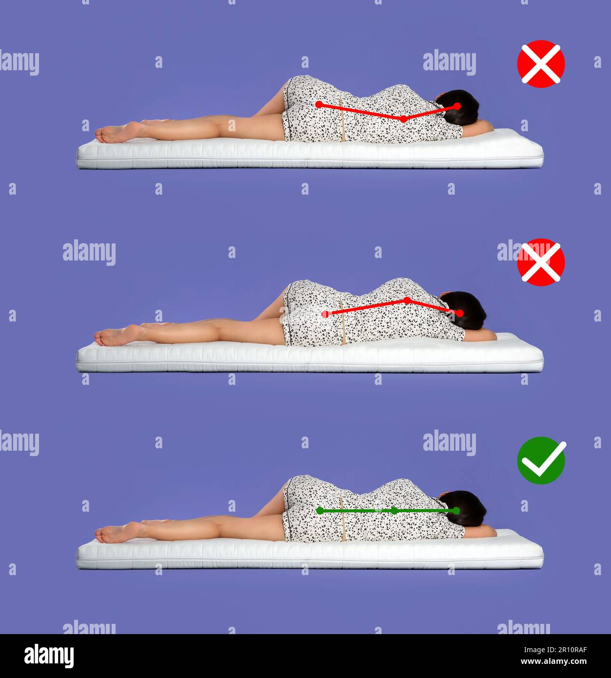 Collage with photos of woman lying on mattress. Wrong and correct ...