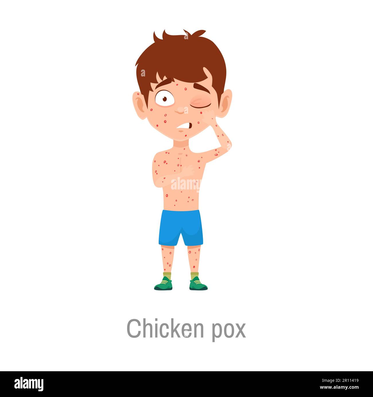 Chicken pox kid sickness, isolated vector sick boy with varicella ...