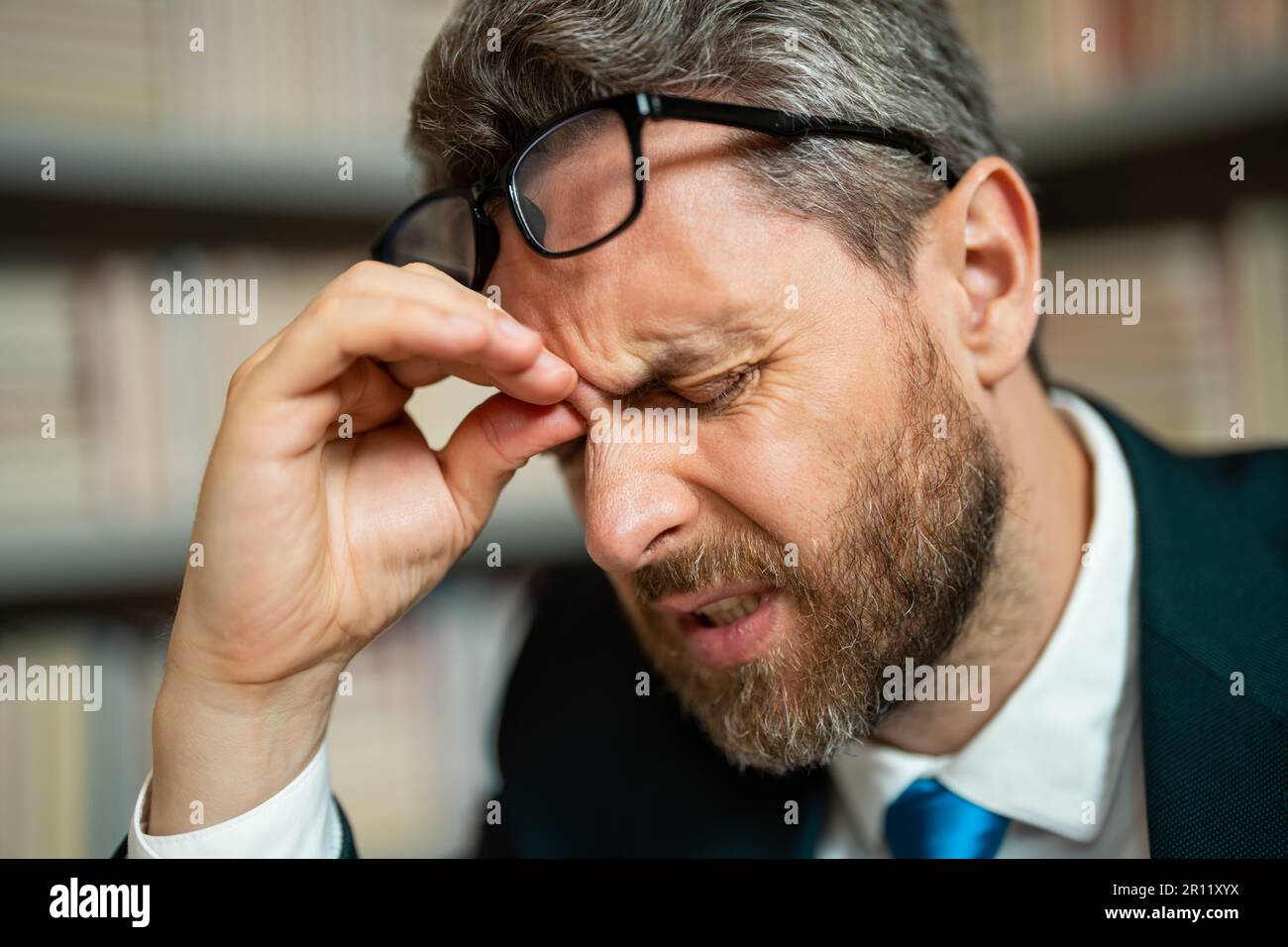 Close up face of stressed man with headache migraine. Overworked man ...