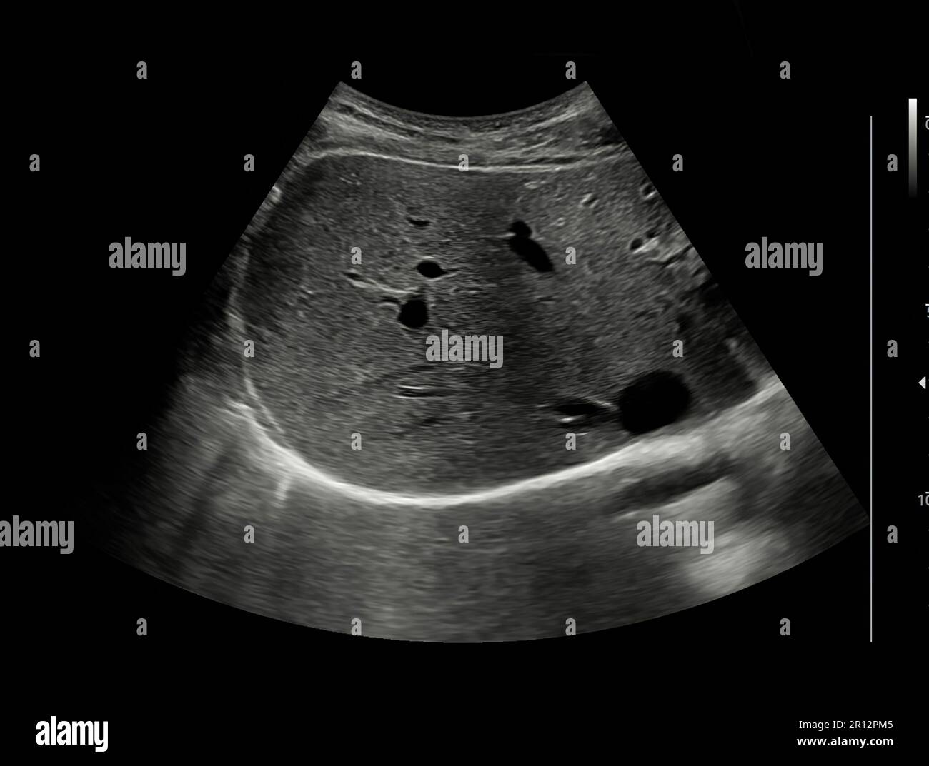 Ultrasound upper abdomen for diagnosis abdominal pain Stock Photo - Alamy