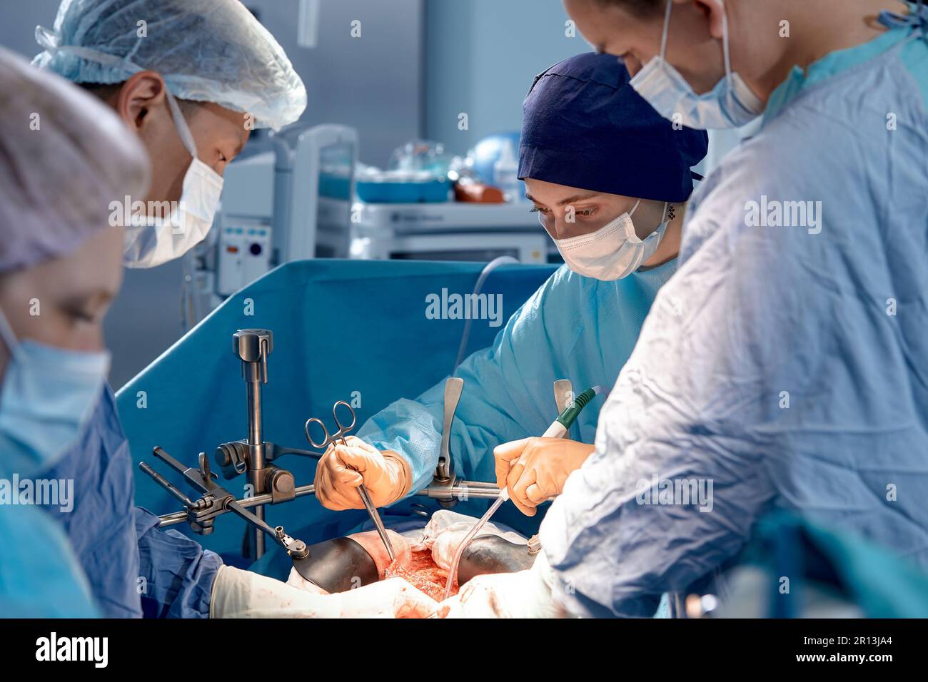 Team of surgeons carefully performing surgery using precise instruments ...