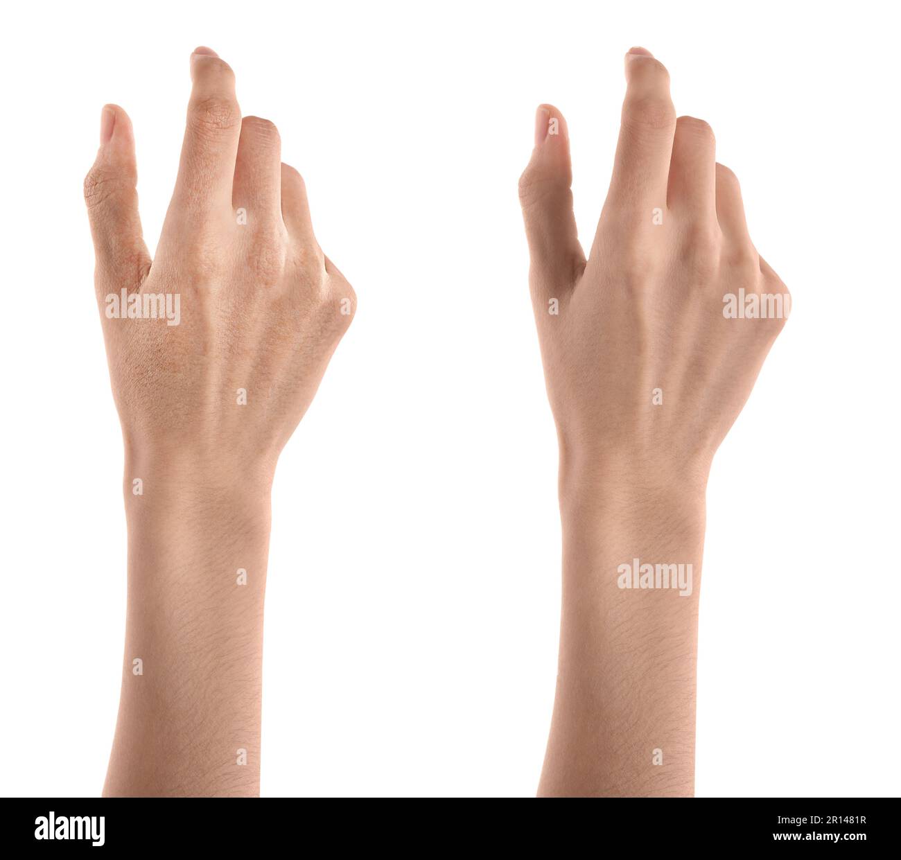 Collage with photos of woman showing hands with dry and moisturized ...