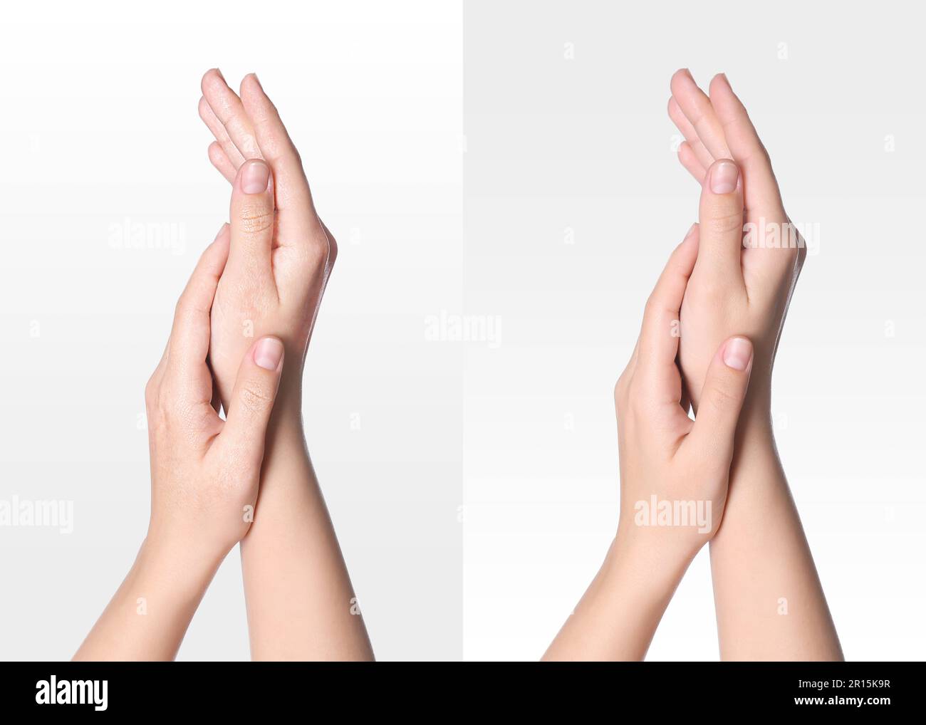 Collage with photos of woman showing hands with dry and moisturized ...