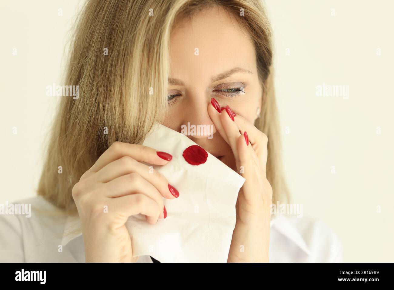 Woman wipes nose tissue hi-res stock photography and images - Alamy