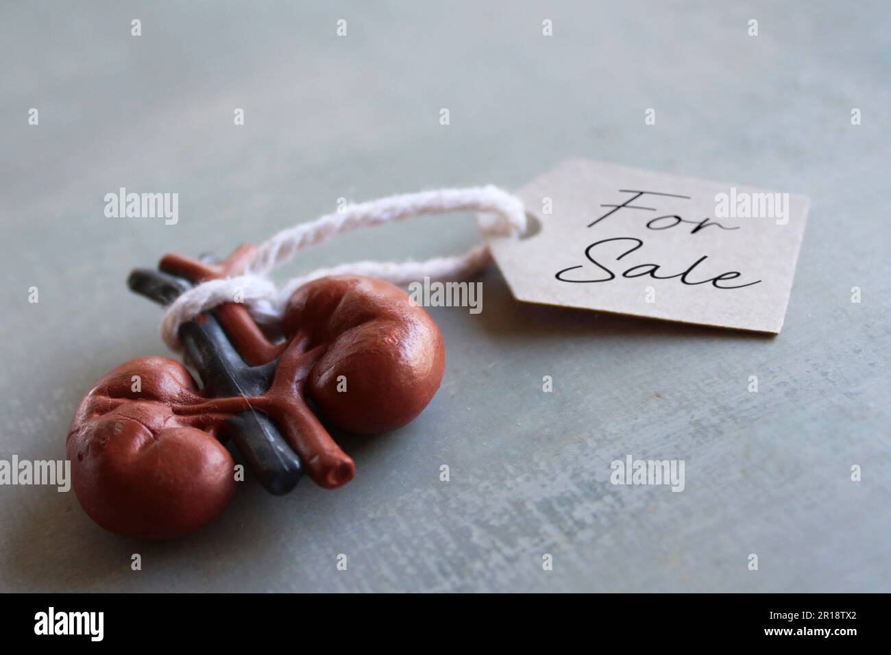 Human kidney with tag FOR SALE. Organ trafficking, organ transplant and ...