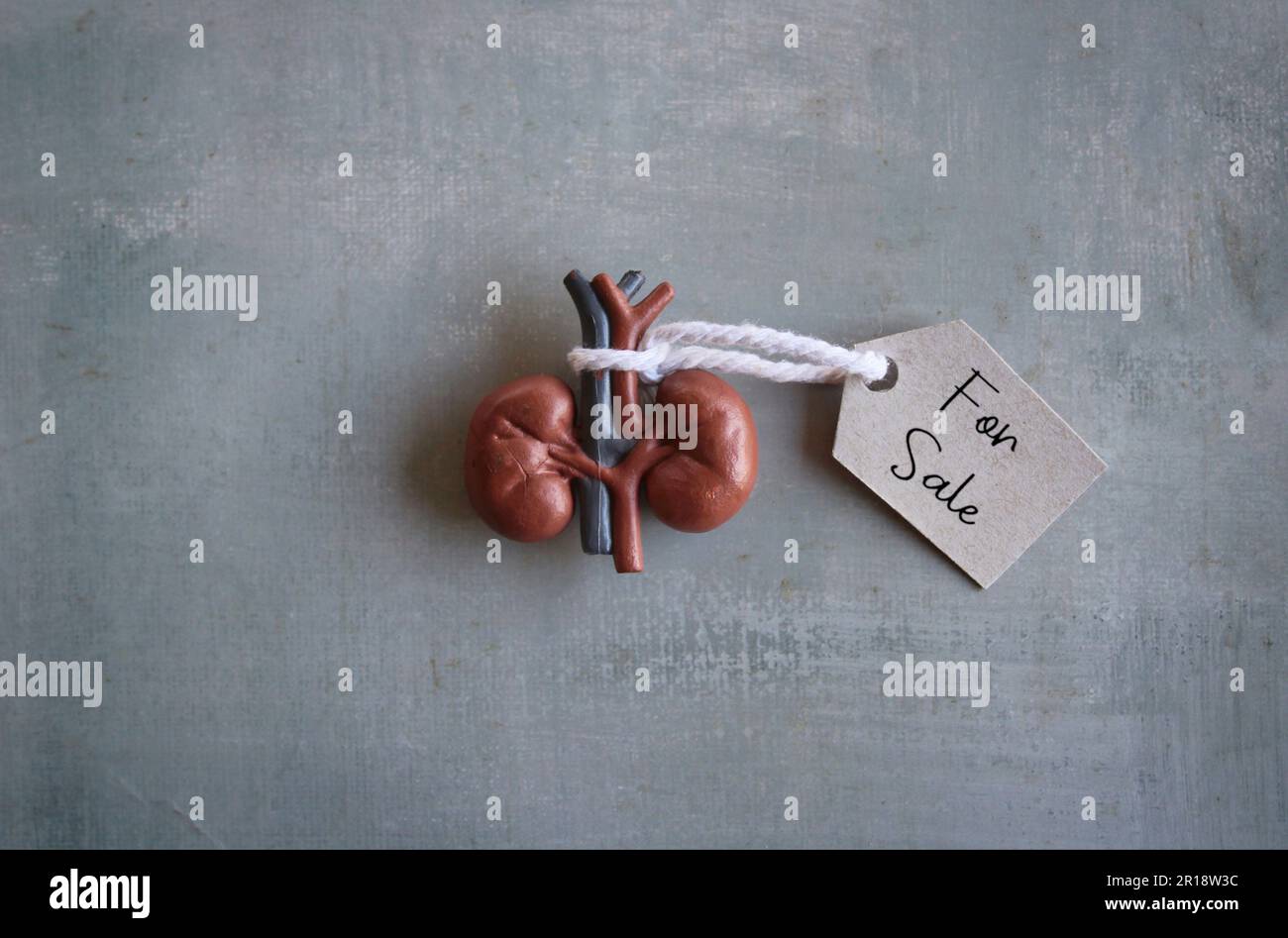 Human kidney with tag FOR SALE. Organ trafficking, organ transplant and ...
