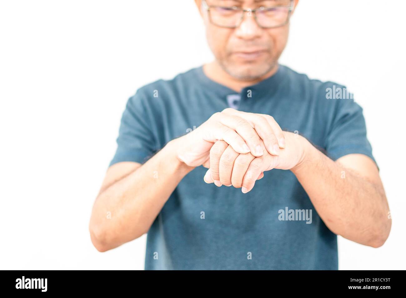 Distal guillain barre syndrome hi-res stock photography and images - Alamy