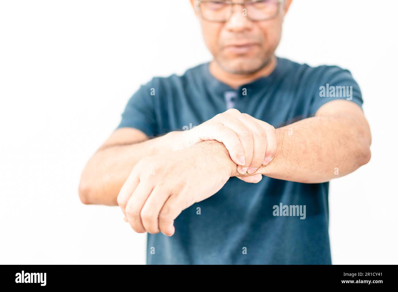 Distal guillain barre syndrome hi-res stock photography and images - Alamy