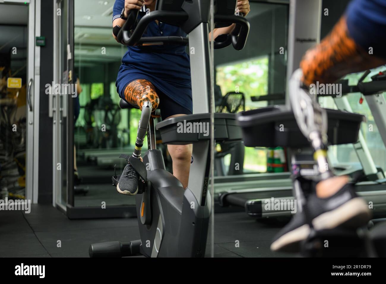 Disabled athlete patient with prosthetic leg doing exercise at gym ...