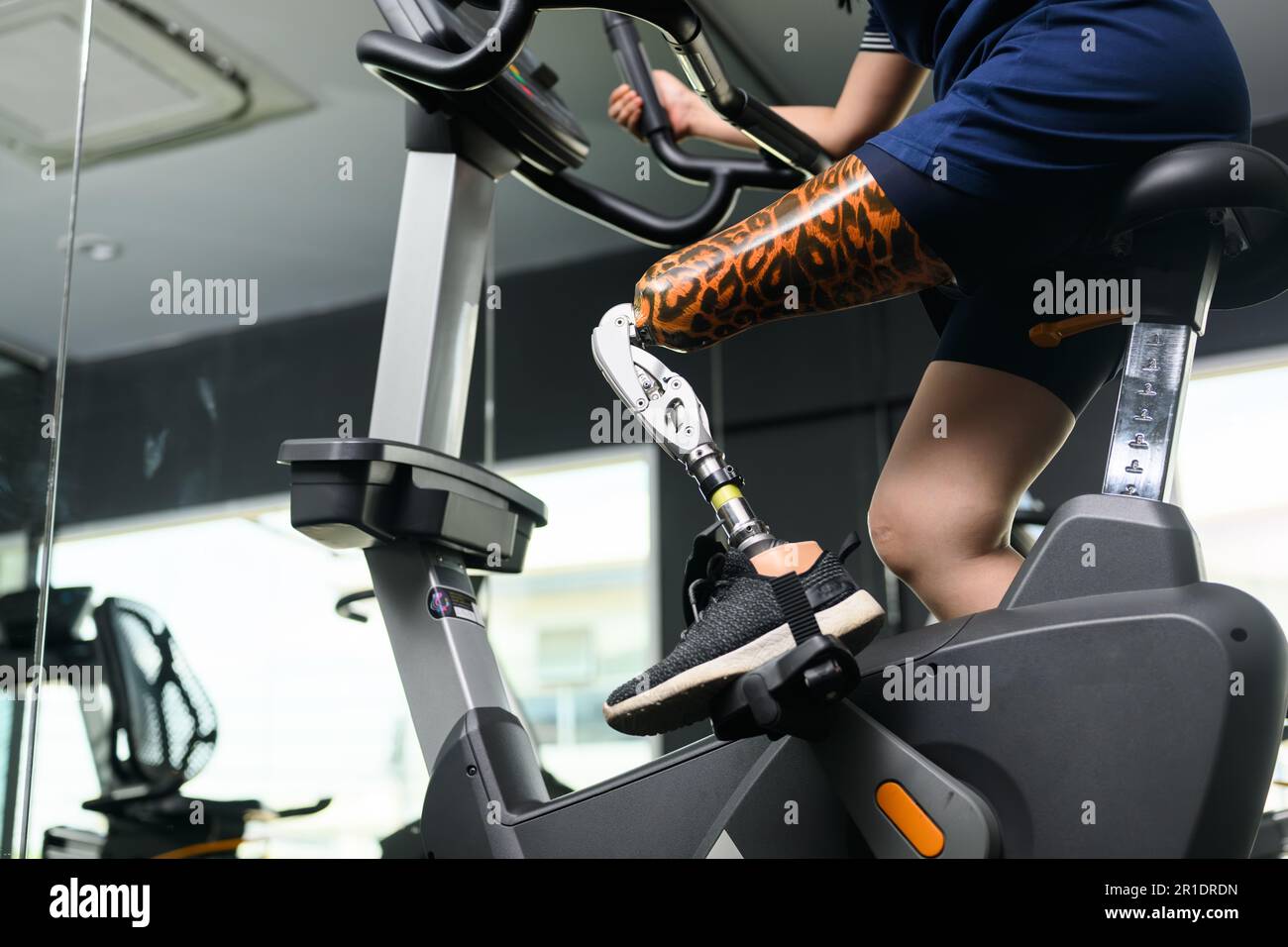 Disabled athlete patient with prosthetic leg doing exercise at gym ...