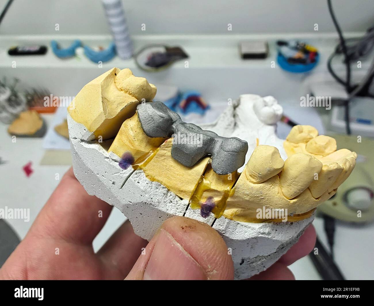 Metal Ceramic Bridge