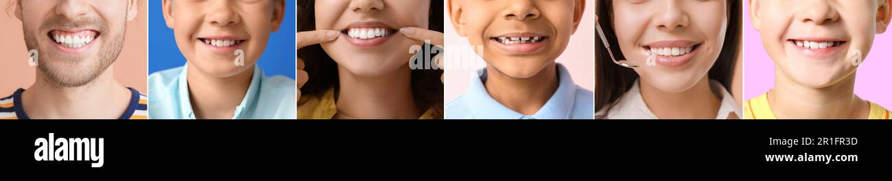Collage of many people with healthy teeth, closeup Stock Photo - Alamy