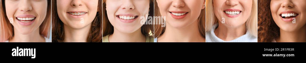 Collage of many women with healthy teeth, closeup Stock Photo - Alamy