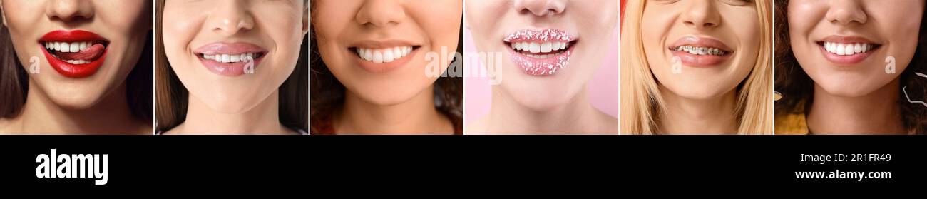 Collage of many women with healthy teeth, closeup Stock Photo - Alamy