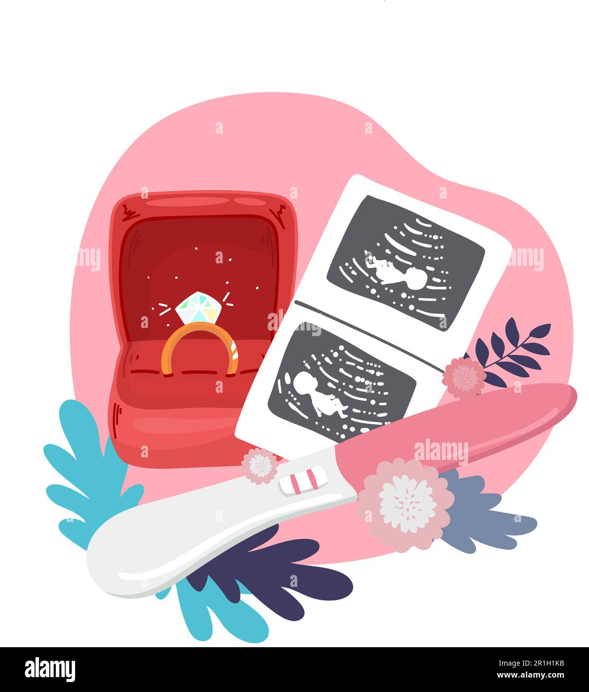 A positive pregnancy test result, a photo of a baby on an ultrasound ...