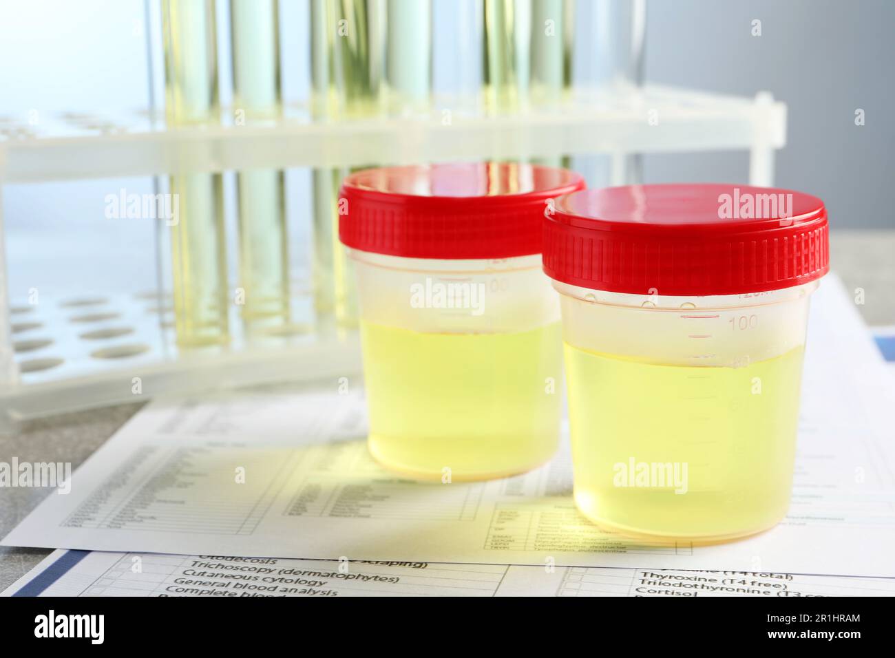 Containers with urine sample for analysis and test form on table in ...