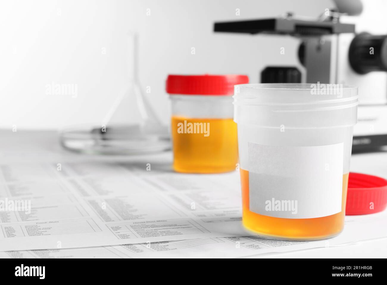 Container with urine sample on table in laboratory, space for text ...