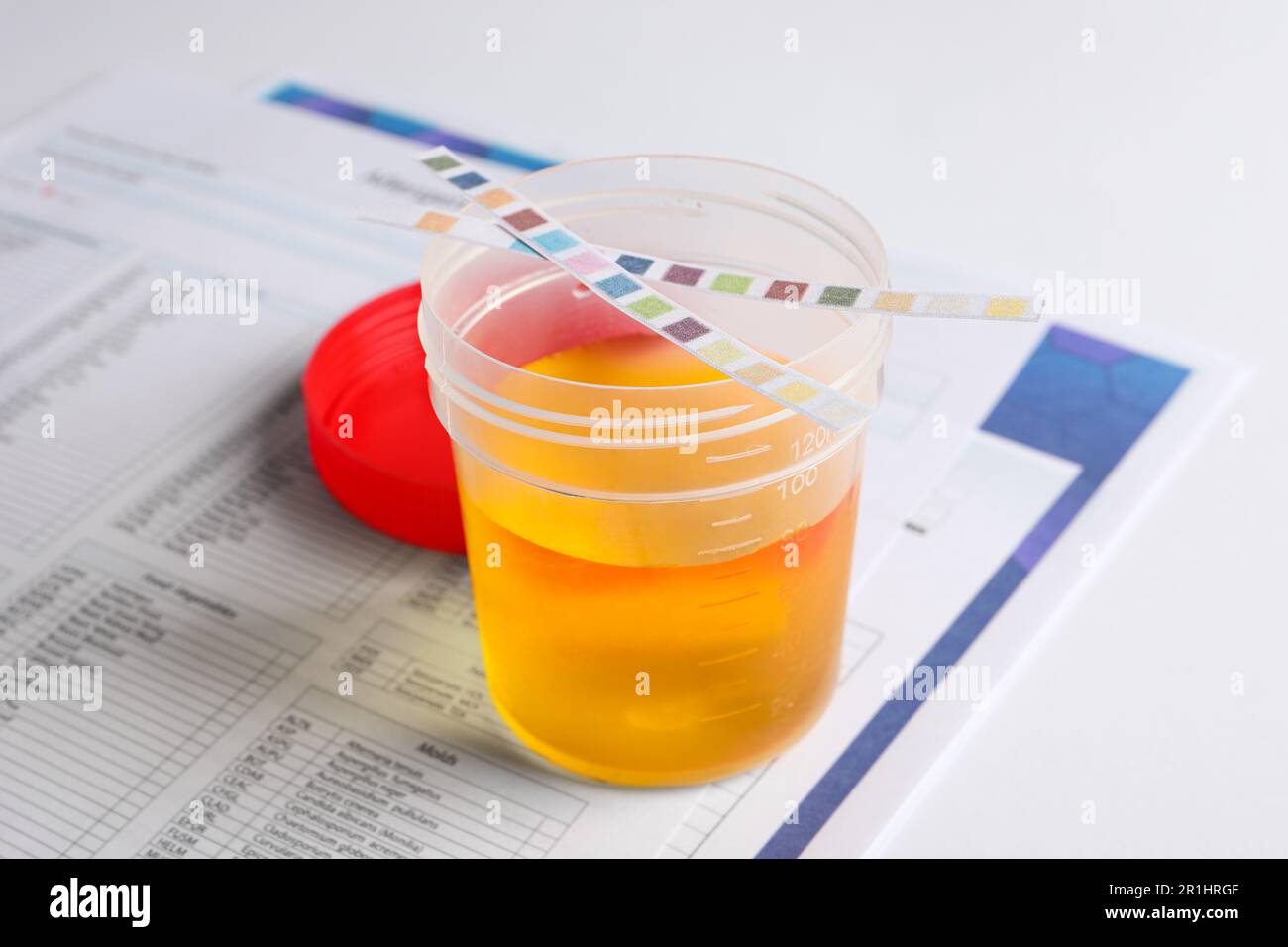 Container with urine sample for analysis and test strips on white table ...