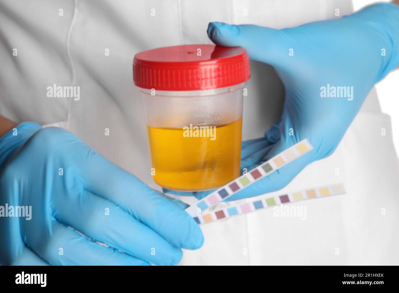 Nurse holding test strips and container with urine sample for analysis ...