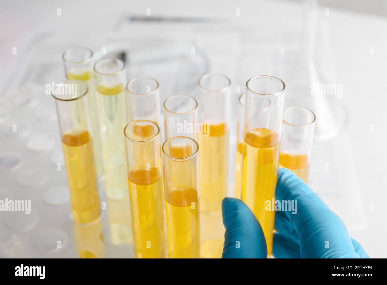 Nurse holding tube with urine sample, closeup. Specimen collection ...