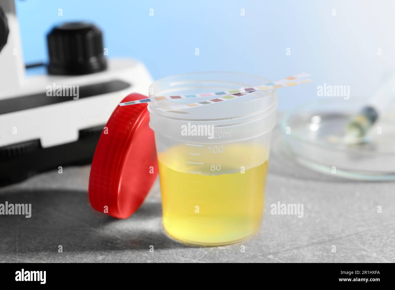 Container with urine sample for analysis and test strips on grey table ...